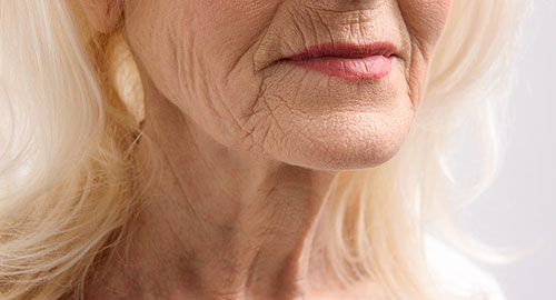 Smooth Neck Wrinkles and Tighten Skin with Specialized Treatments in ...